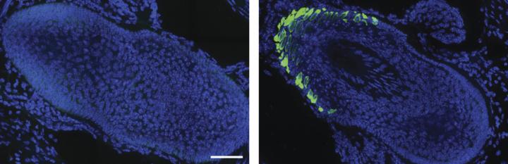 Merkel Cell Deficiency [IMAGE] | EurekAlert! Science News Releases