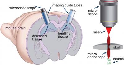 Deepbrain Apparatus [IMAGE] | EurekAlert! Science News Releases
