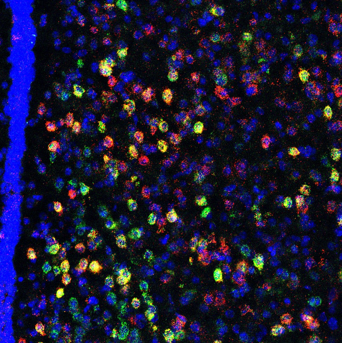 Heightened activity of specific brain cells f | EurekAlert!