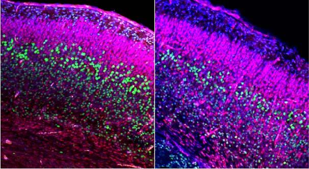 Embryonic Layering of the Brai [IMAGE] | EurekAlert! Science News Releases