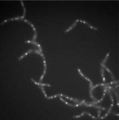 Anthrax Cells (2 of 2) [IMAGE] | EurekAlert! Science News Releases