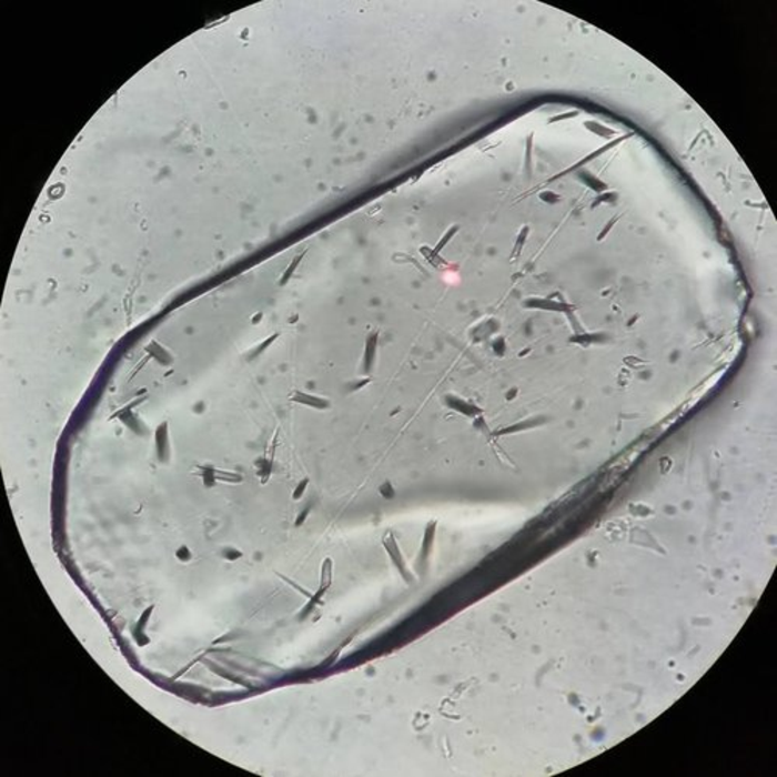 Apatite crystal under a micros [IMAGE] | EurekAlert! Science News Releases