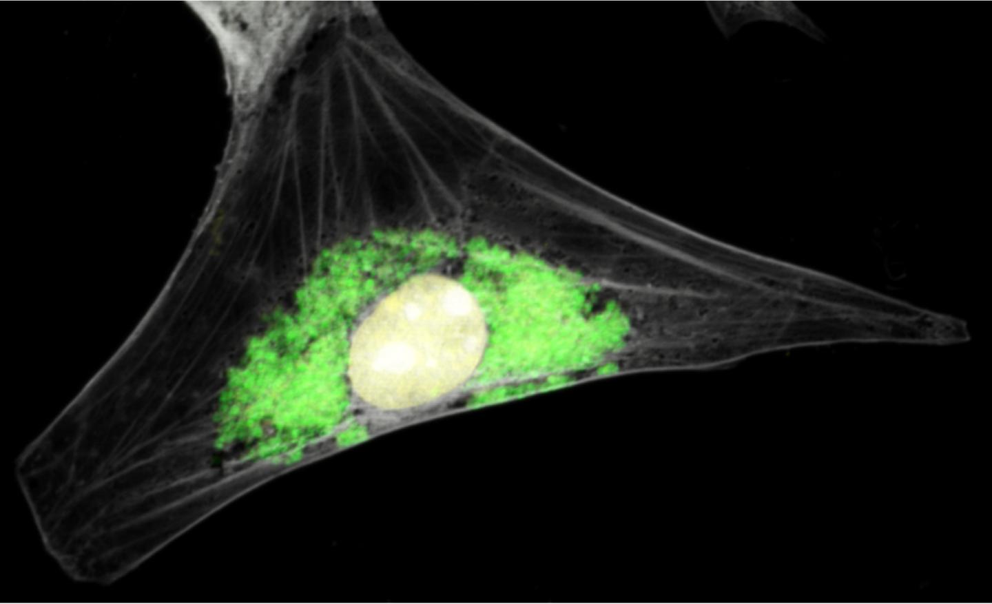 Guinea Pig Cell Infected with [IMAGE] | EurekAlert! Science News Releases