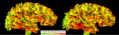 Brain Maturation Measured by C [IMAGE] | EurekAlert! Science News Releases