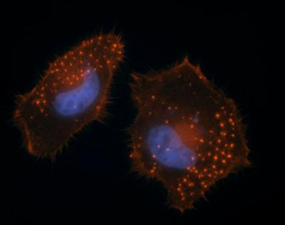 Invadopodia [IMAGE] | EurekAlert! Science News Releases