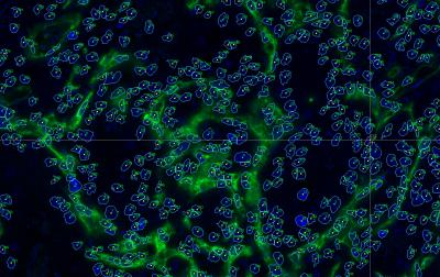 FARSIGHT [IMAGE] | EurekAlert! Science News Releases