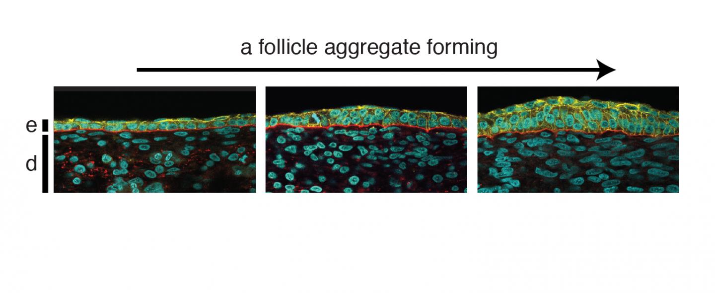 Cell Aggregation in the Dermis [IMAGE] | EurekAlert! Science News Releases