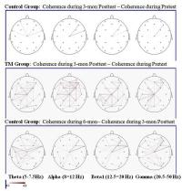 Coherence Difference Maps (Brain Connectivity | EurekAlert!
