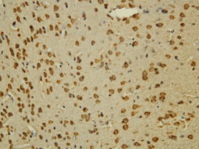 How does acupuncture at Baihui and Dazhui red | EurekAlert!