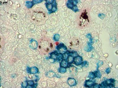 Malaria Parasites Get Down to the Bone (2 of | EurekAlert!