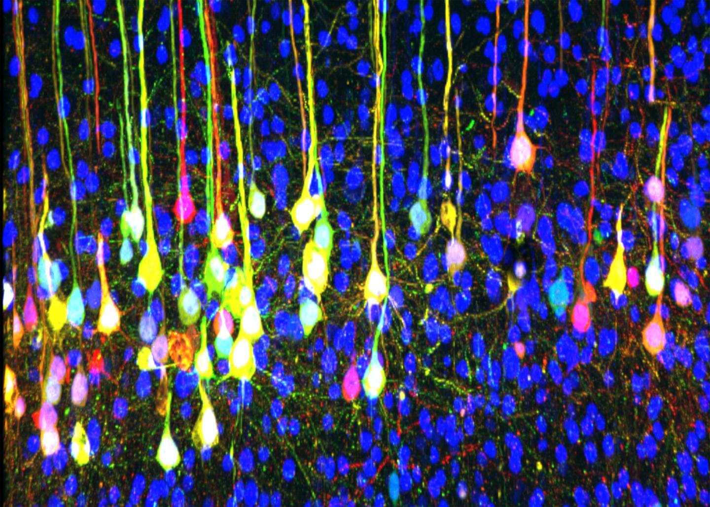 Neuron Tracing [IMAGE] | EurekAlert! Science News Releases