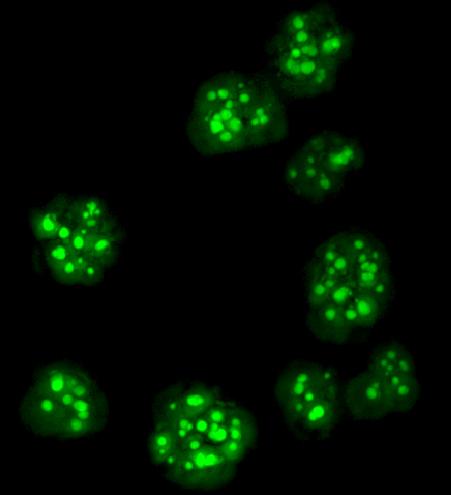 Vip1-1 Cells [IMAGE] | EurekAlert! Science News Releases
