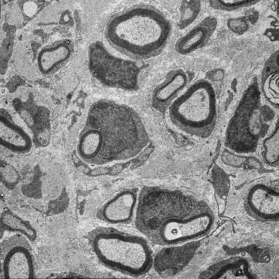 Cross-Section Axon [IMAGE] | EurekAlert! Science News Releases