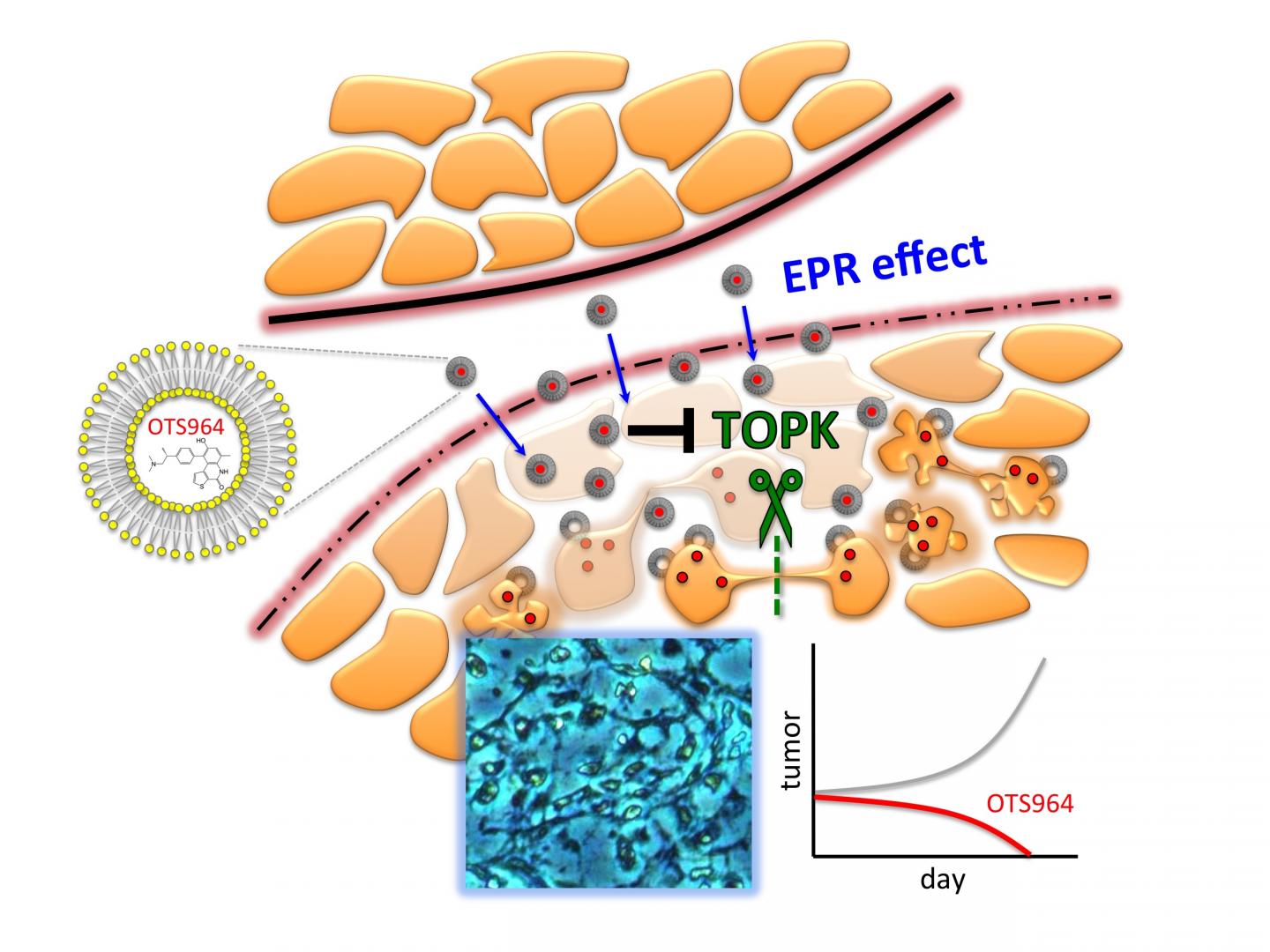 OTS964 in Action [IMAGE] | EurekAlert! Science News Releases