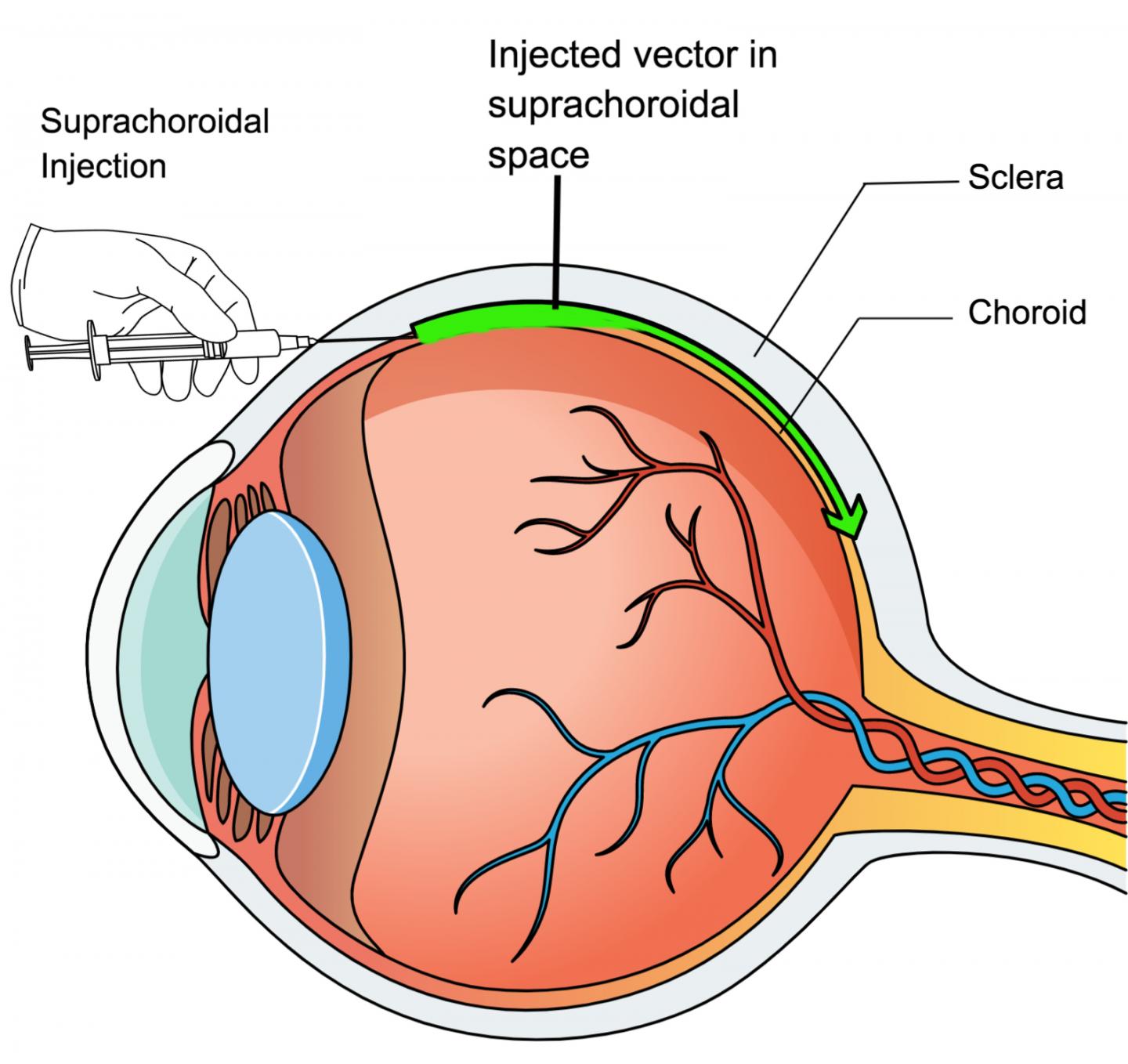 Graphical Abstract [IMAGE] | EurekAlert! Science News Releases