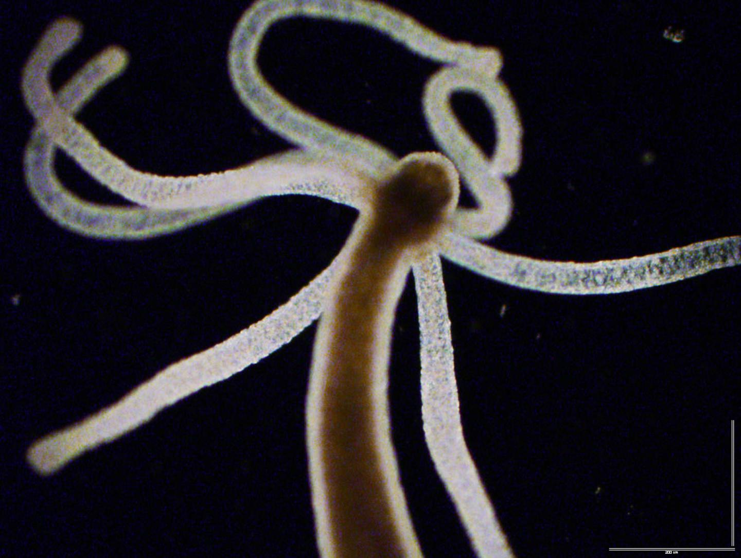 Nanoparticles Enhance Light Sensitivity in Ey | EurekAlert!