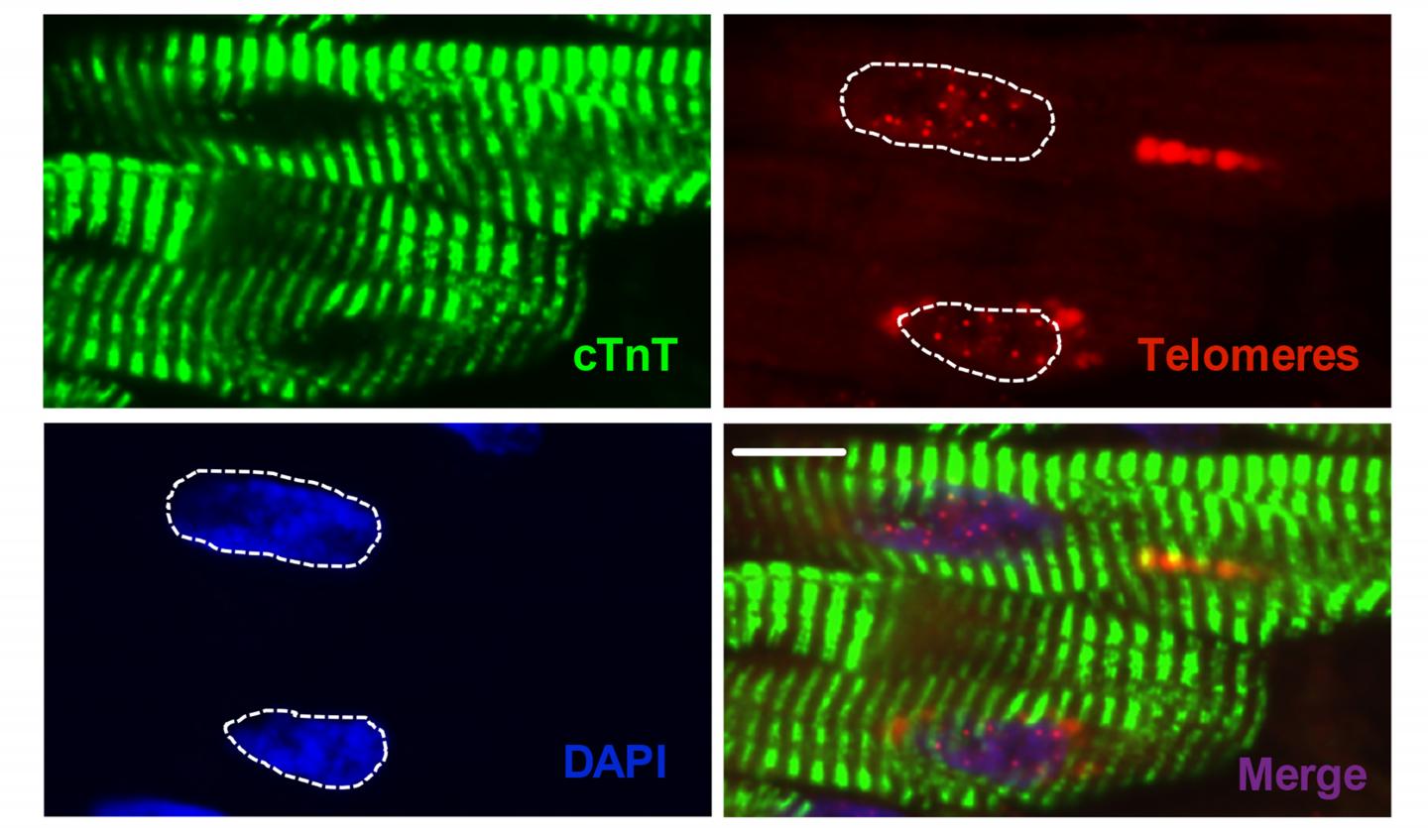 Telomeres [IMAGE] | EurekAlert! Science News Releases