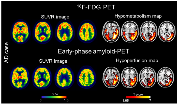 New dual-phase imaging protocol reduces costs | EurekAlert!