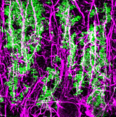Close-up Of Astrocyte Activity [IMAGE] | EurekAlert! Science News Releases