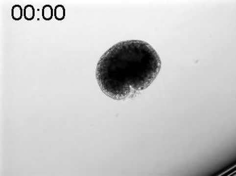 How hydras know where to regrow lost body par | EurekAlert!