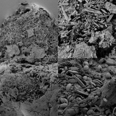 Electron Microscope Images of [IMAGE] | EurekAlert! Science News Releases