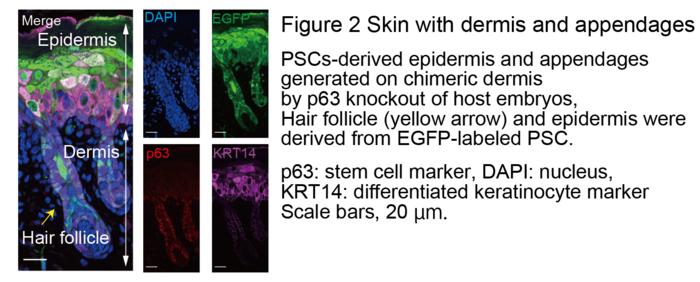 Figure 2 Skin with dermis and [IMAGE] | EurekAlert! Science News Releases
