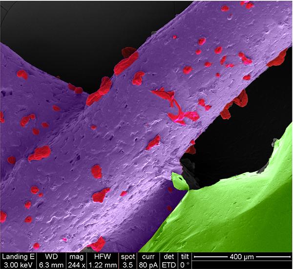 Bone Construction [IMAGE] | EurekAlert! Science News Releases
