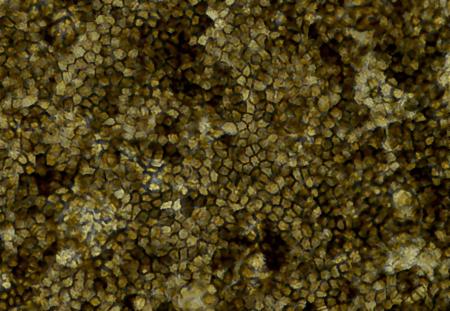 iPSC RPE Light Microscopy, Uni [IMAGE] | EurekAlert! Science News Releases