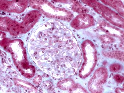 BIOMARGIN -- Increasing the life span of graf | EurekAlert!