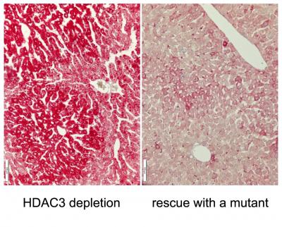 Liver Stained for Fat with Oil [IMAGE] | EurekAlert! Science News Releases