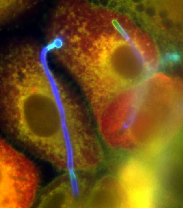 Candida albicans hyphae enters [IMAGE] | EurekAlert! Science News Releases