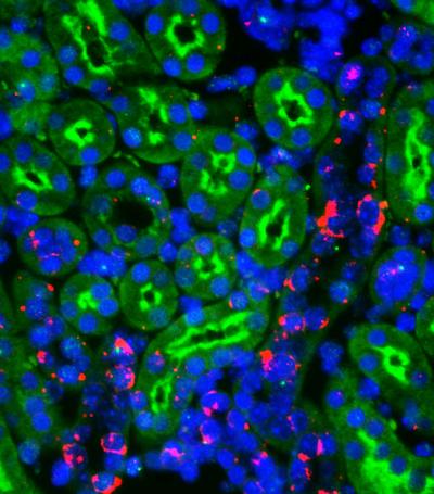 Microscope Imageof a Kidney [IMAGE] | EurekAlert! Science News Releases