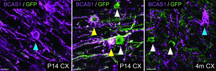 Tapping into Neuroprotective Cells for Potent | EurekAlert!