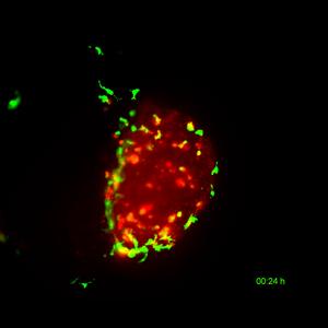 Scientists unravel how the BCG vaccine leads | EurekAlert!