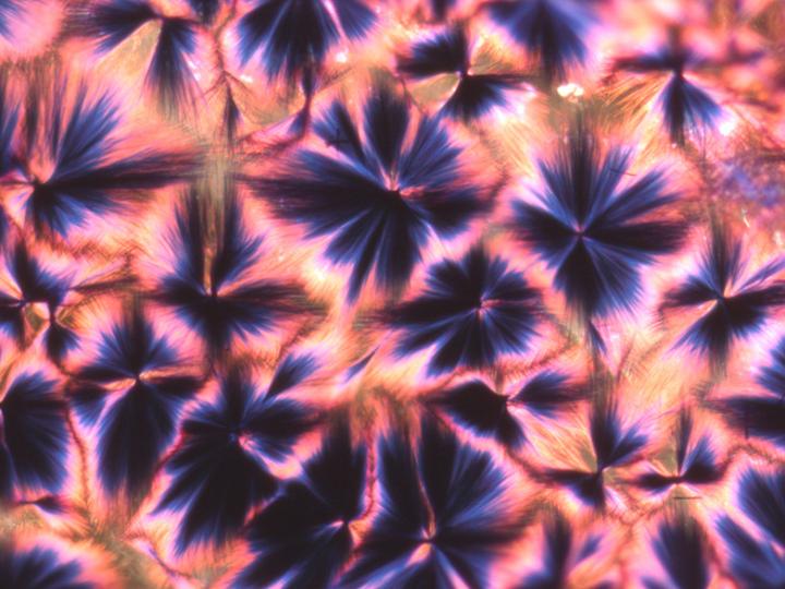 Birefringence Signal [IMAGE] | EurekAlert! Science News Releases