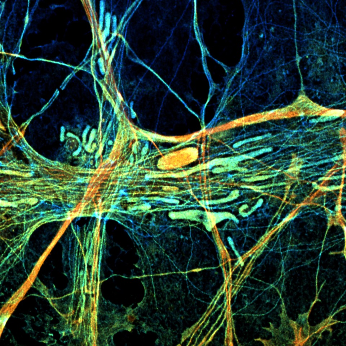 Limiting energy in neurons exa [IMAGE] | EurekAlert! Science News Releases