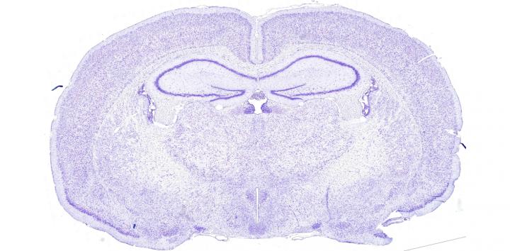 Histology [IMAGE] | EurekAlert! Science News Releases