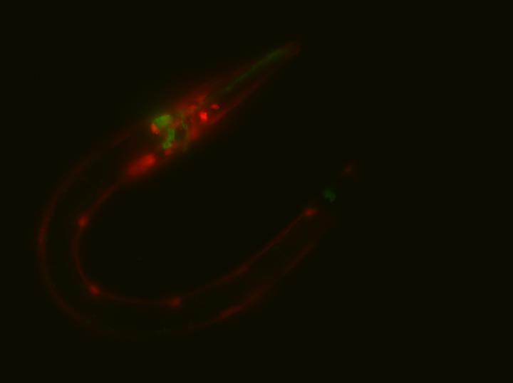 C. Elegans Under A Microscope [IMAGE] | EurekAlert! Science News Releases