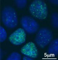 Typhoid toxin increases host survival and pro | EurekAlert!