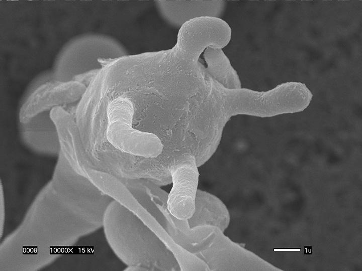 Spores on Cryptococcus deut [IMAGE] | EurekAlert! Science News Releases