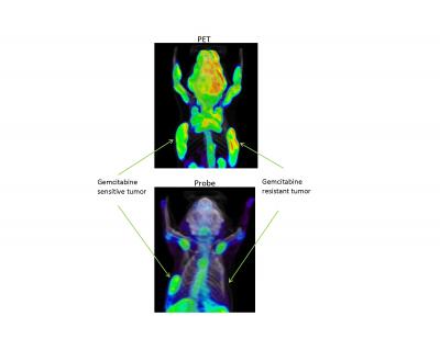 Tumors Glow Under PET Scan [IMAGE] | EurekAlert! Science News Releases