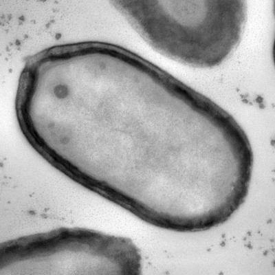 Supersized Viruses Break Recor [IMAGE] | EurekAlert! Science News Releases