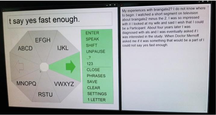 Typing with BrainGate [IMAGE] | EurekAlert! Science News Releases
