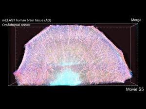 Alzheimer's tissue labeled [VIDEO] | EurekAlert! Science News Releases