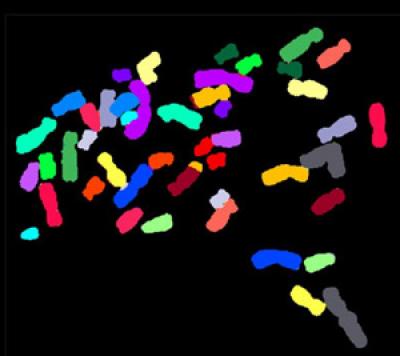 Chromosomes [IMAGE] | EurekAlert! Science News Releases