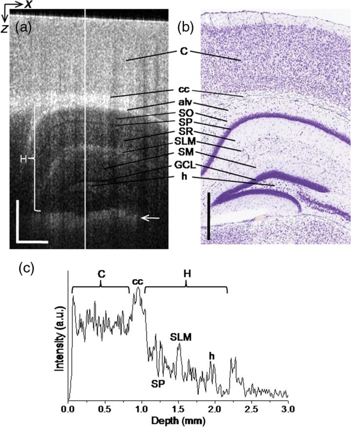 In Vivo 1.3-μm VCSEL SS-OCT [IMAGE] | EurekAlert! Science News Releases