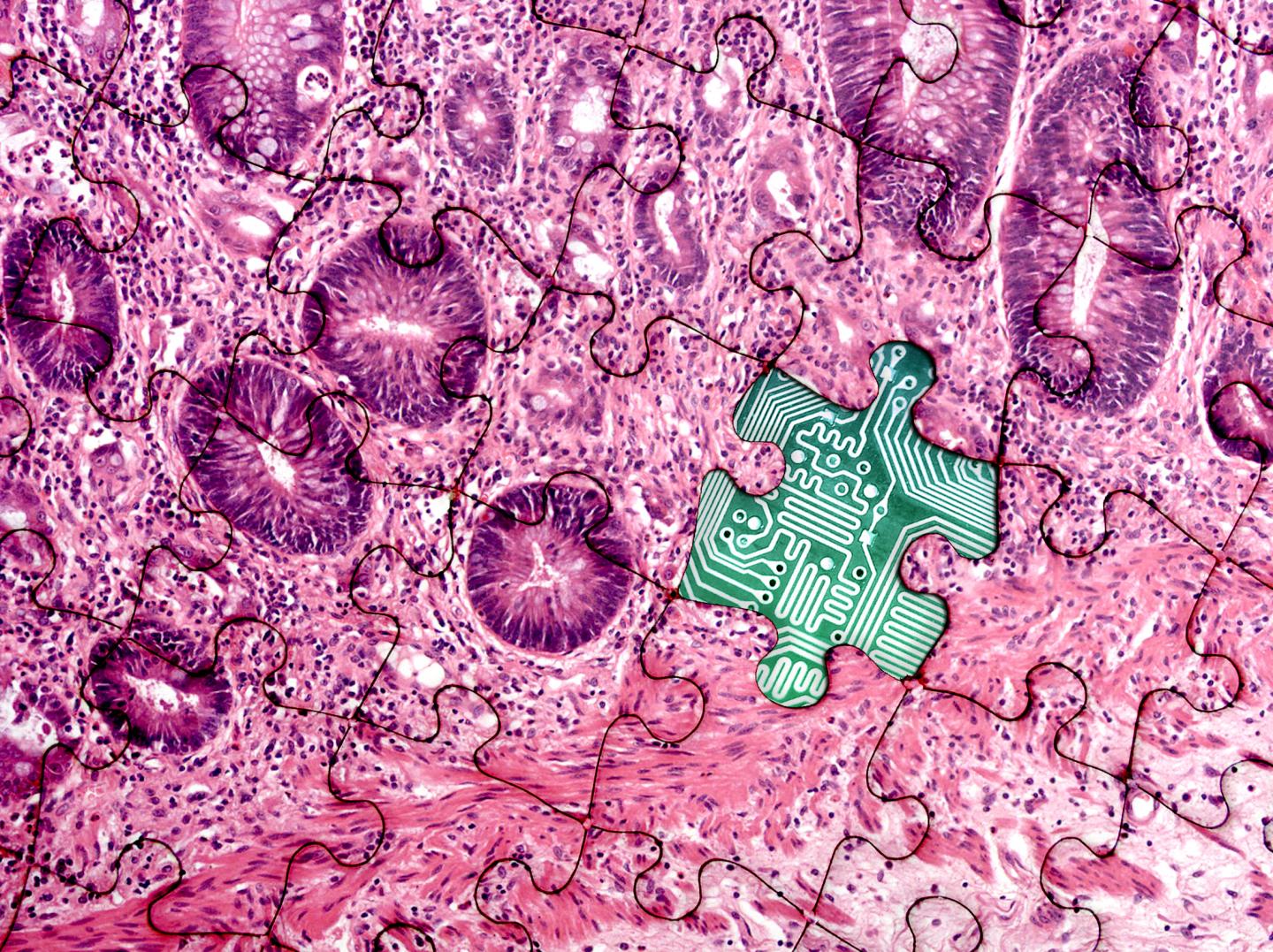 Digital Pathology [IMAGE] | EurekAlert! Science News Releases