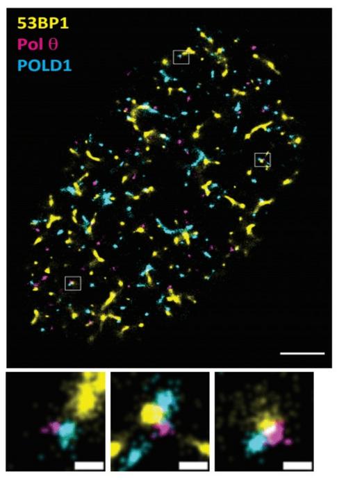 Scientists piece together DNA repair pathway | EurekAlert!