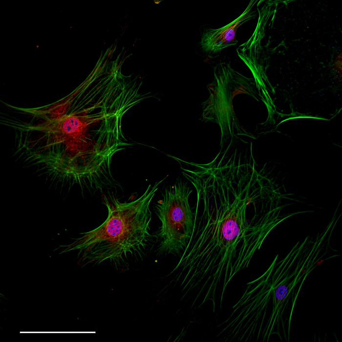 Cardiac fibroblasts [IMAGE] | EurekAlert! Science News Releases