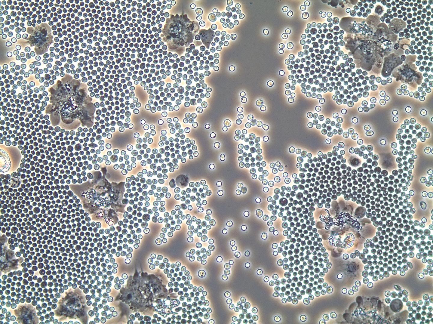 Crab Blood and Collaborations [IMAGE] | EurekAlert! Science News Releases